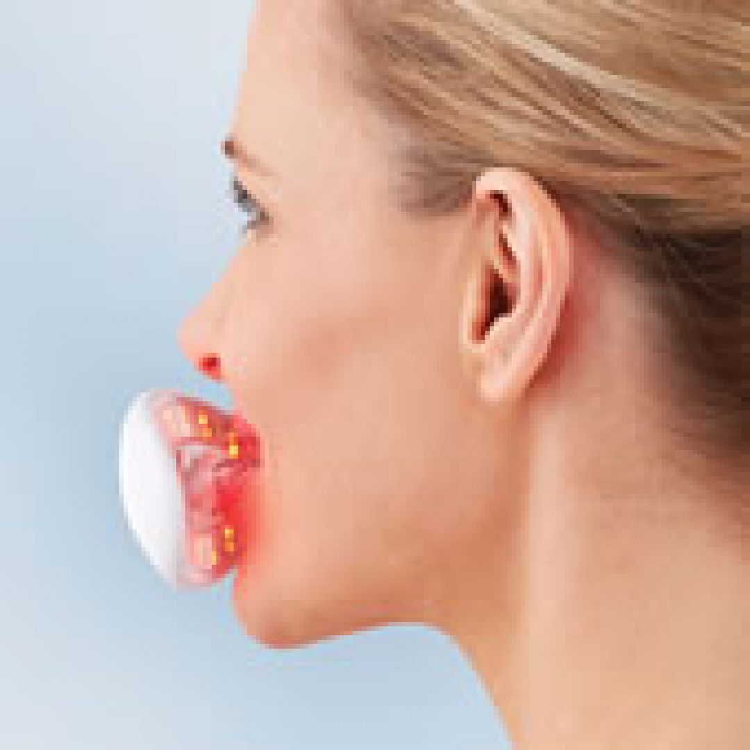 Infrared LED Lip Rejuvenator for Wrinkle Reduction and Fuller Lips ...